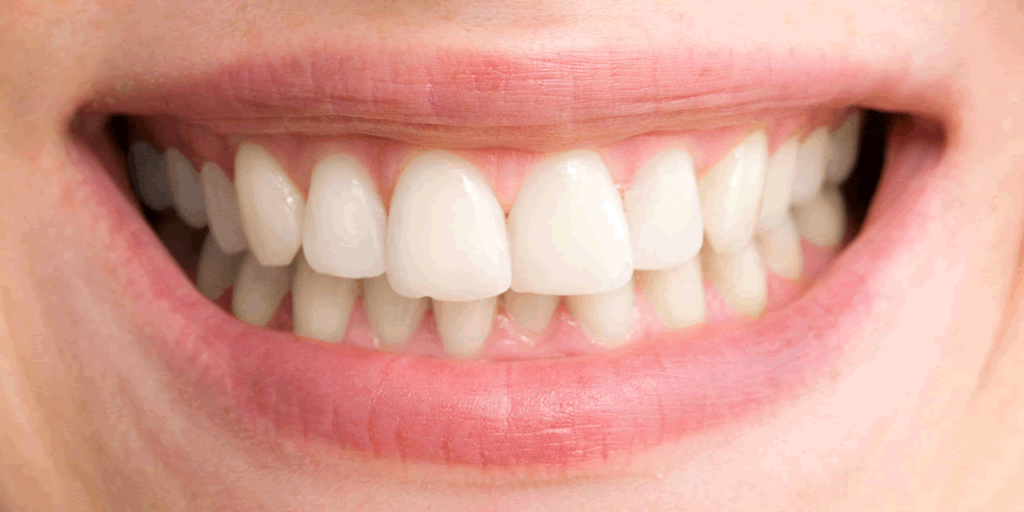 A importância dos cuidados com a gengiva – Amil Dental